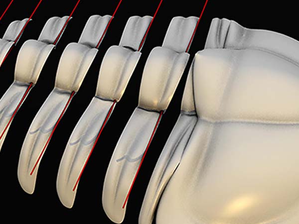 Digital Fossils: Using X-ray to Uncover Secrets of the Past | Oxford ...